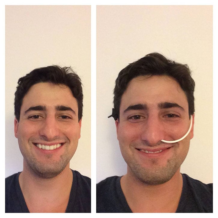 What I learnt from being tube-fed by feeding tube for a week (Part 1)